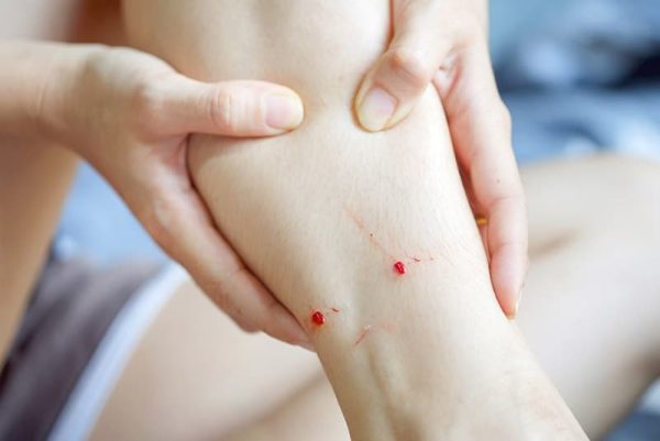 Cat Love Bites: What They Mean & Why They Happen - Catster