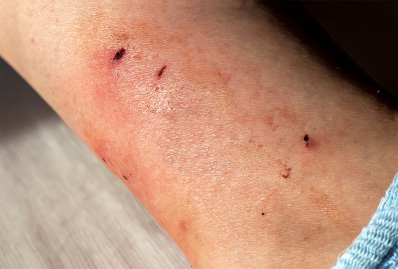 What to Do When a Cat Bites You: Vet-Reviewed Steps to Take & Risks ...