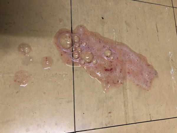 Why Is My Cat Throwing Up Pink Liquid? Our Vet Explains 10 Reasons ...